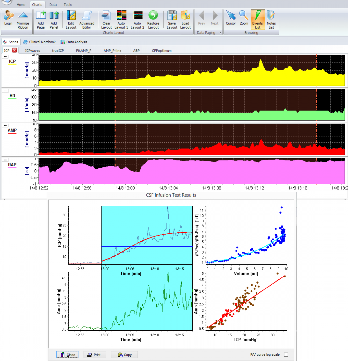ICM+ Features | Cambridge Enterprise ICM+