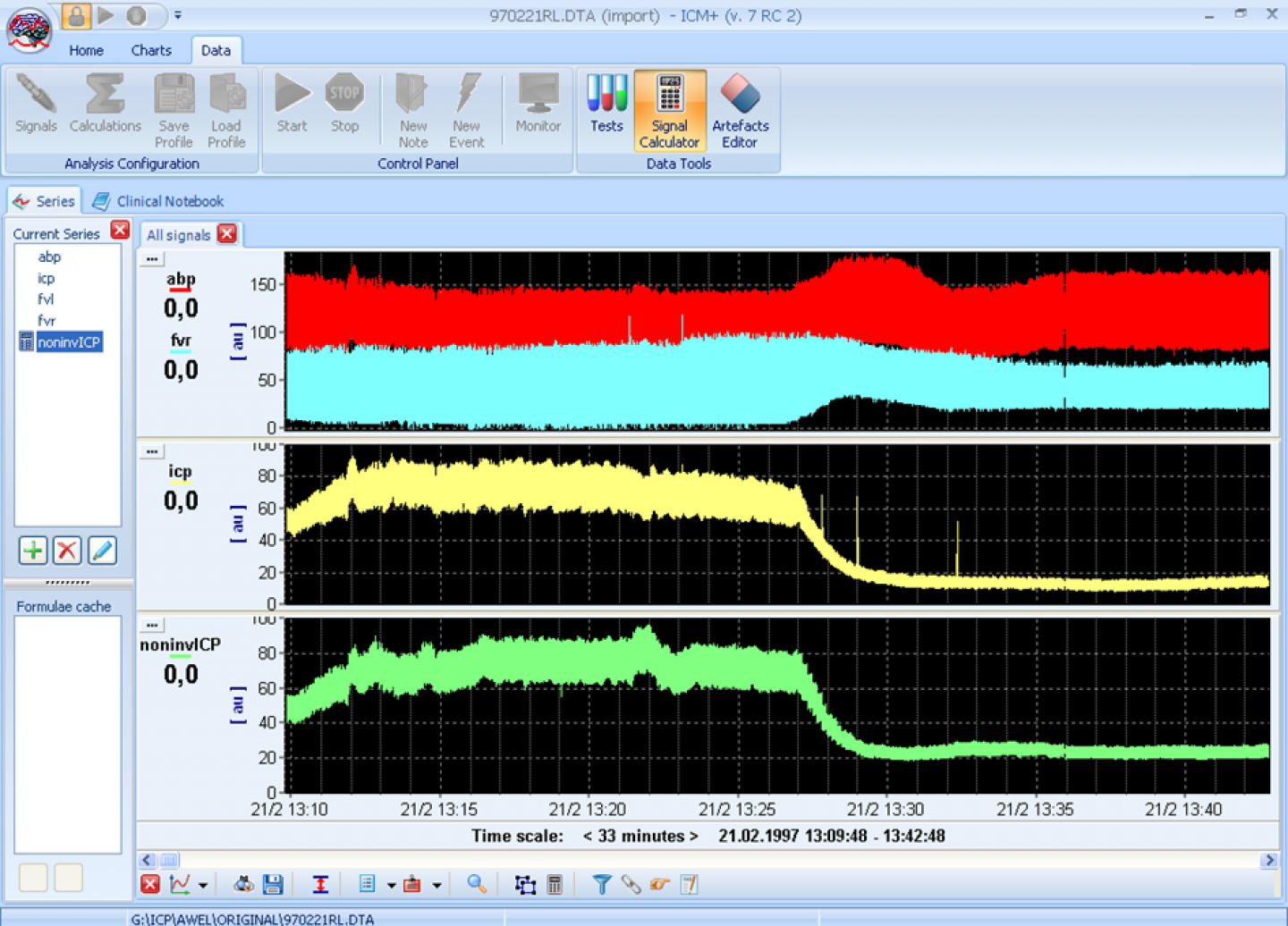 nICP Plugin | Cambridge Enterprise ICM+