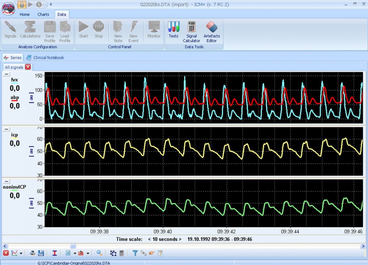 nICP Plugin | Cambridge Enterprise ICM+