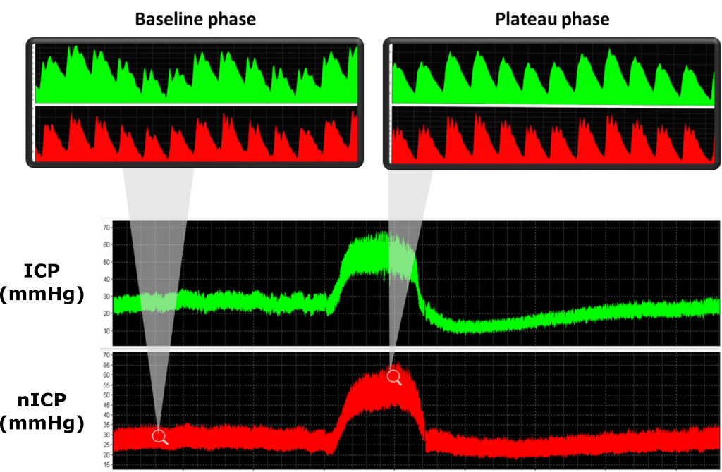 Figure Plateau wave | Cambridge Enterprise ICM+