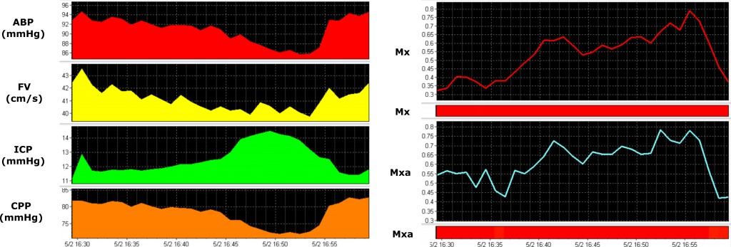 Figure TBI autoregulation | Cambridge Enterprise ICM+