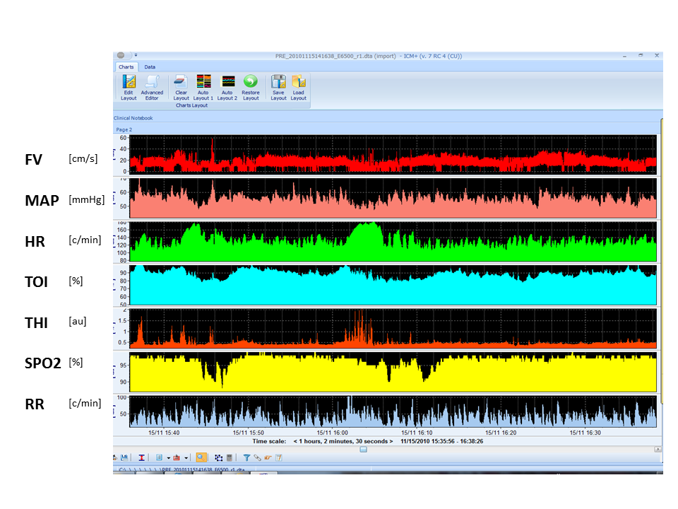 Neo1 | Cambridge Enterprise ICM+